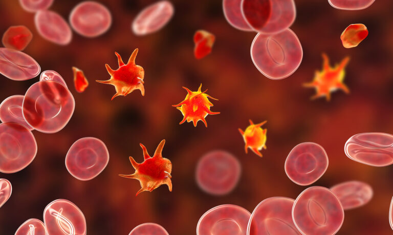 A Guide to Idiopathic Thrombocytopenic Purpura (ITP)