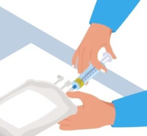 A Complete Step-by-Step Guide to Administering TPN at Home