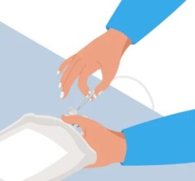 A Complete Step-by-Step Guide to Administering TPN at Home