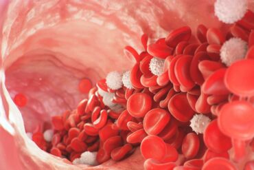 Hemophagocytic Lymphohistiocytosis (HLH) - AmeriPharma® Specialty Care