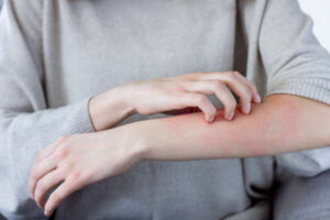 Mavyret: A Highly Effective Treatment for Chronic Hepatitis C
