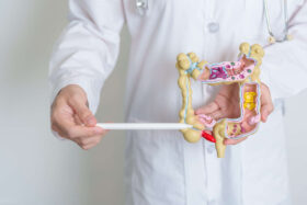 Vectibix: A Targeted Treatment for Colorectal Cancer - AmeriPharma ...