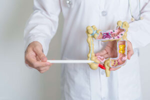 Vectibix: A Targeted Treatment for Colorectal Cancer - AmeriPharma ...