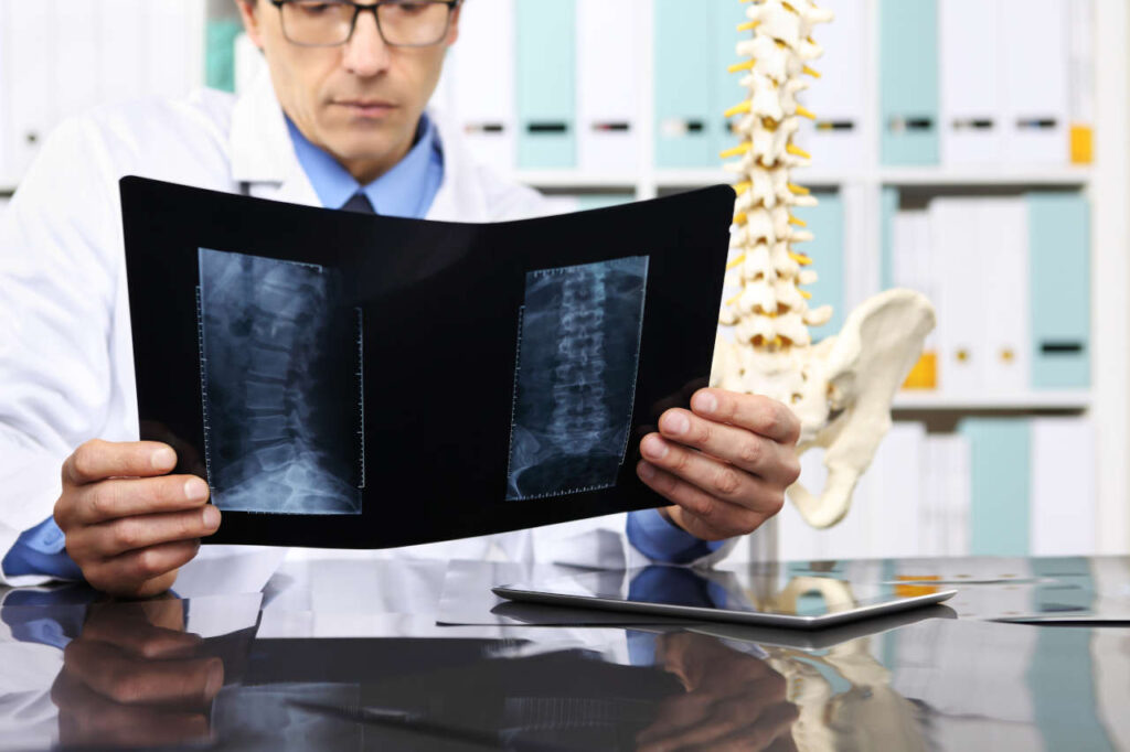 Ankylosing Spondylitis: Causes, Risks, Diagnosis, and Treatment ...