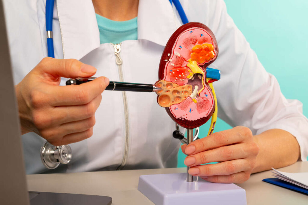 IVIG for Solid Organ Transplantation - AmeriPharma® Specialty Care